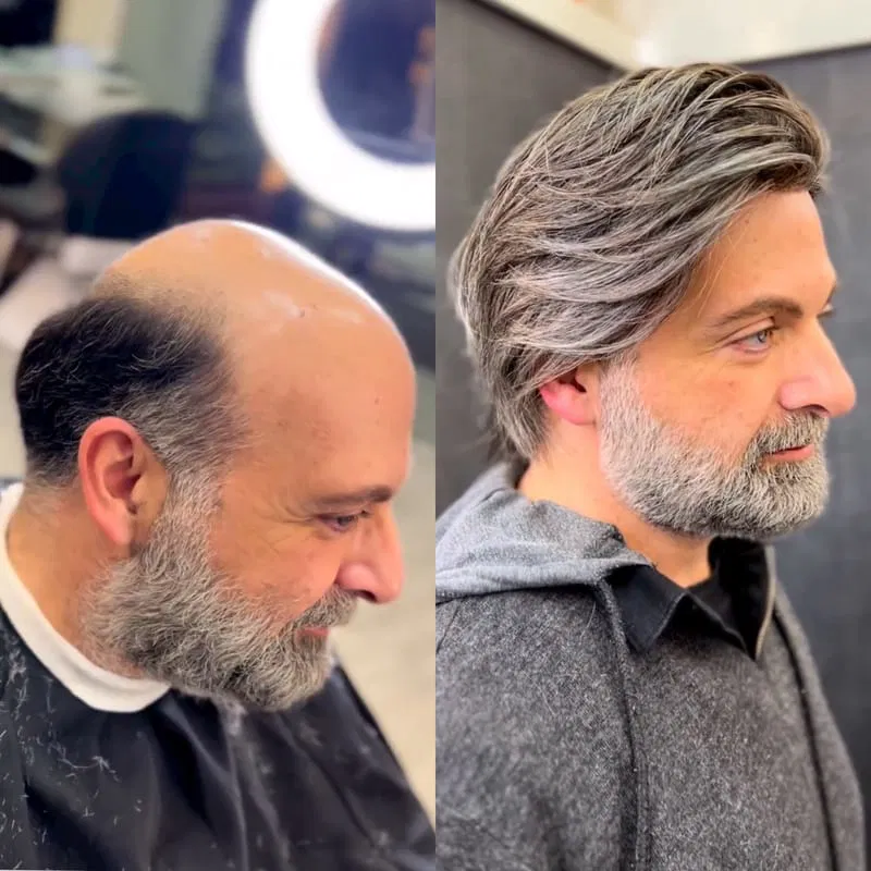 HAIR SYSTEMS INTRODUCTION – AY